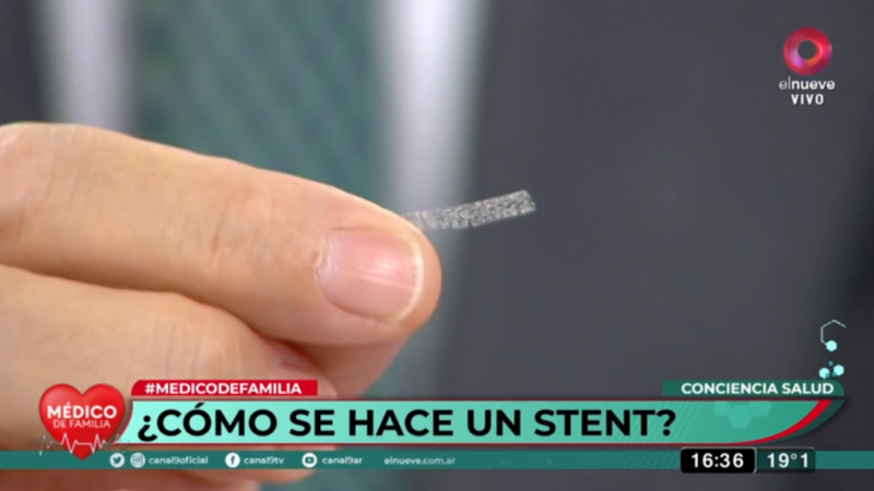 Qué es y cómo funciona un stent, revolución de la medicina argentina ...