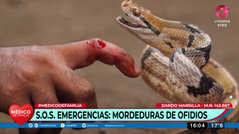 Mordedura de una serpiente: qué hacer y qué no en una emergencia | Canal 9